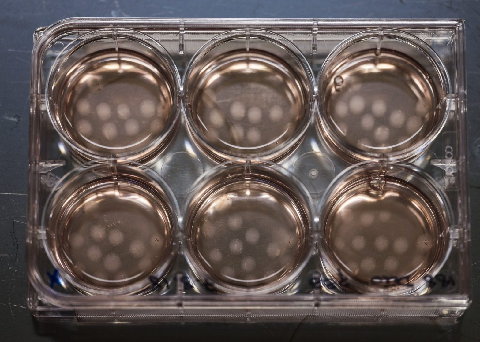 The weird and wonderful world of organoids - Wellcome Sanger Institute Blog