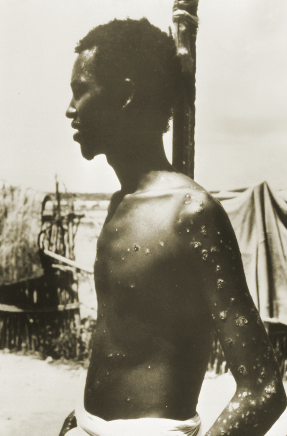 Vaccines: Life savers against infectious diseases - Wellcome Sanger ...